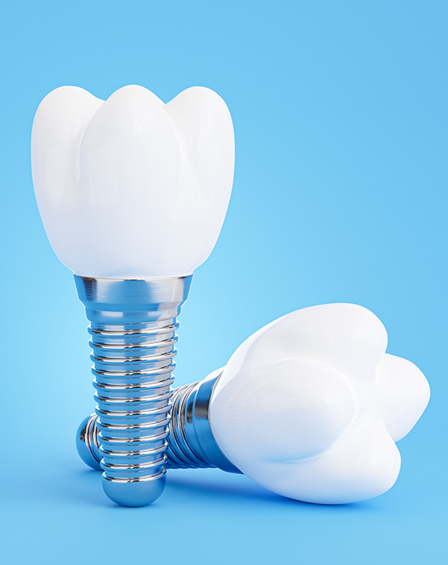 Dental Insurance Plans with Implants | Delta Dental of New Jersey